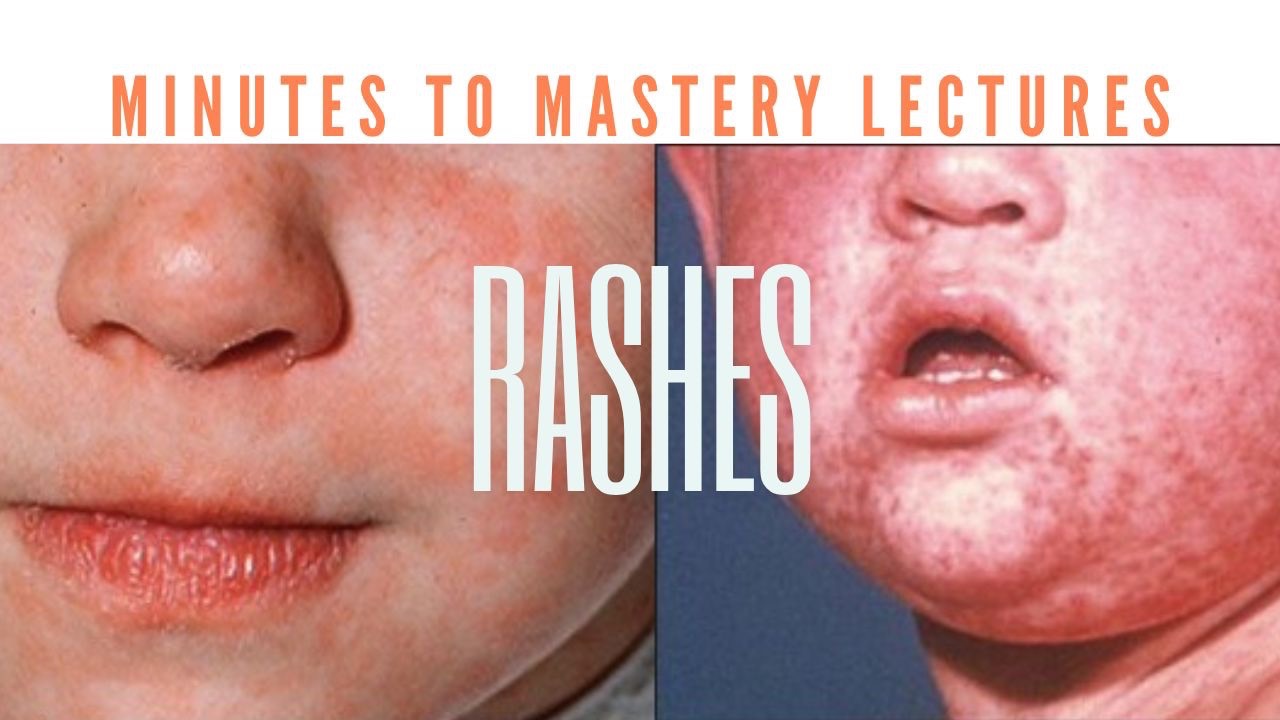 Rashes