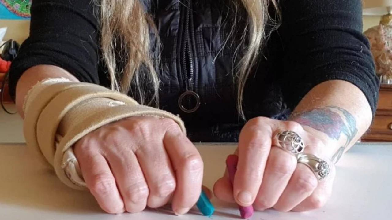 Healing a Broken Wrist with Guided Drawing