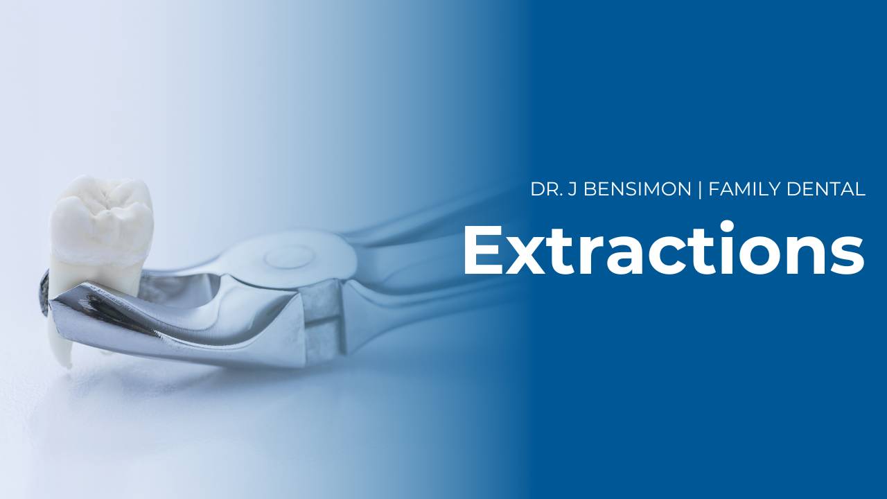 DR. J BENSIMON | FAMILY DENTAL - Extractions