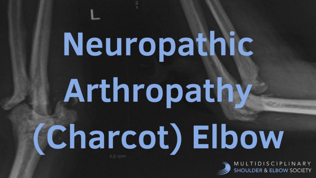 Neuropathic Arthropathy (Charcot) Elbow