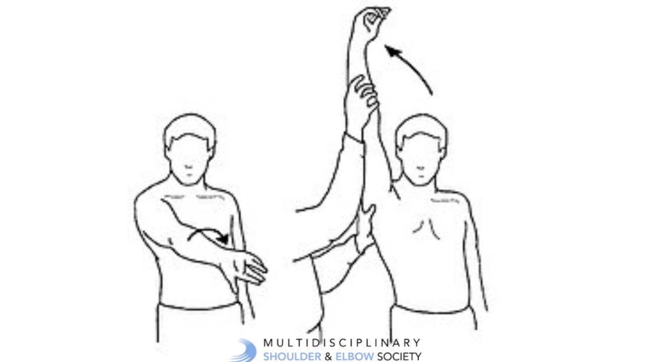 Subacromial Impingement Examination Tests