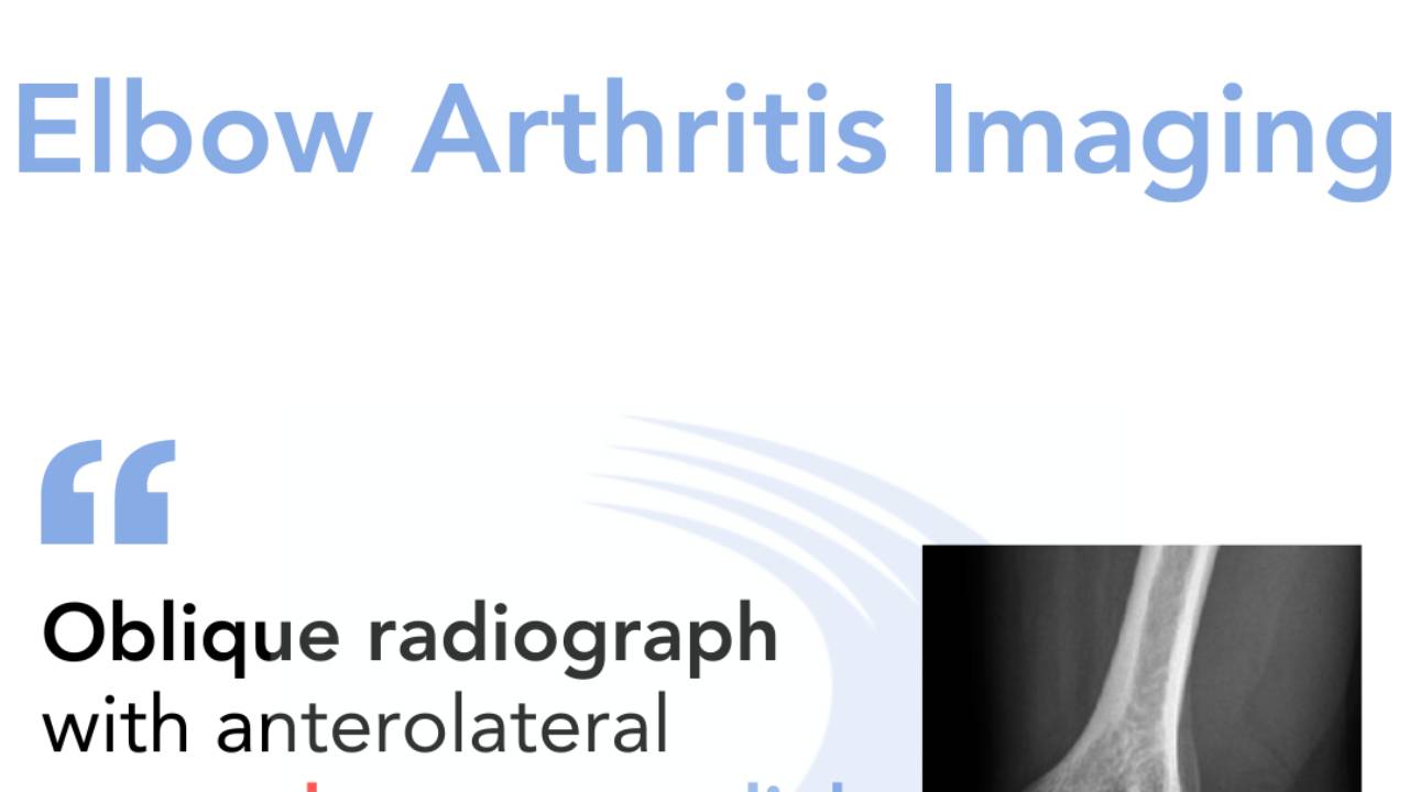 Elbow Arthritis Imaging Clinical Pearls