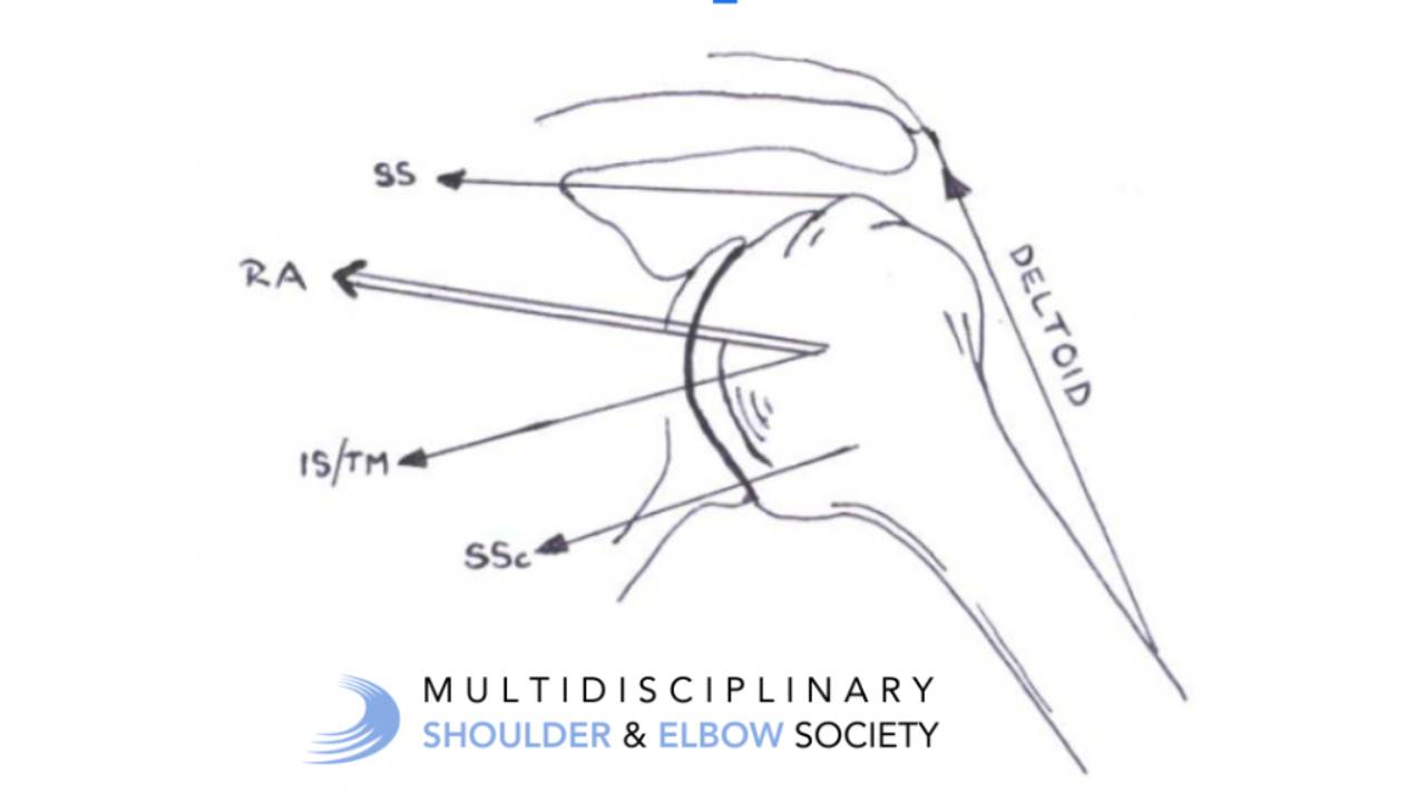 Clinical Pearls: Rotator Cuff and Deltoid Force Couple