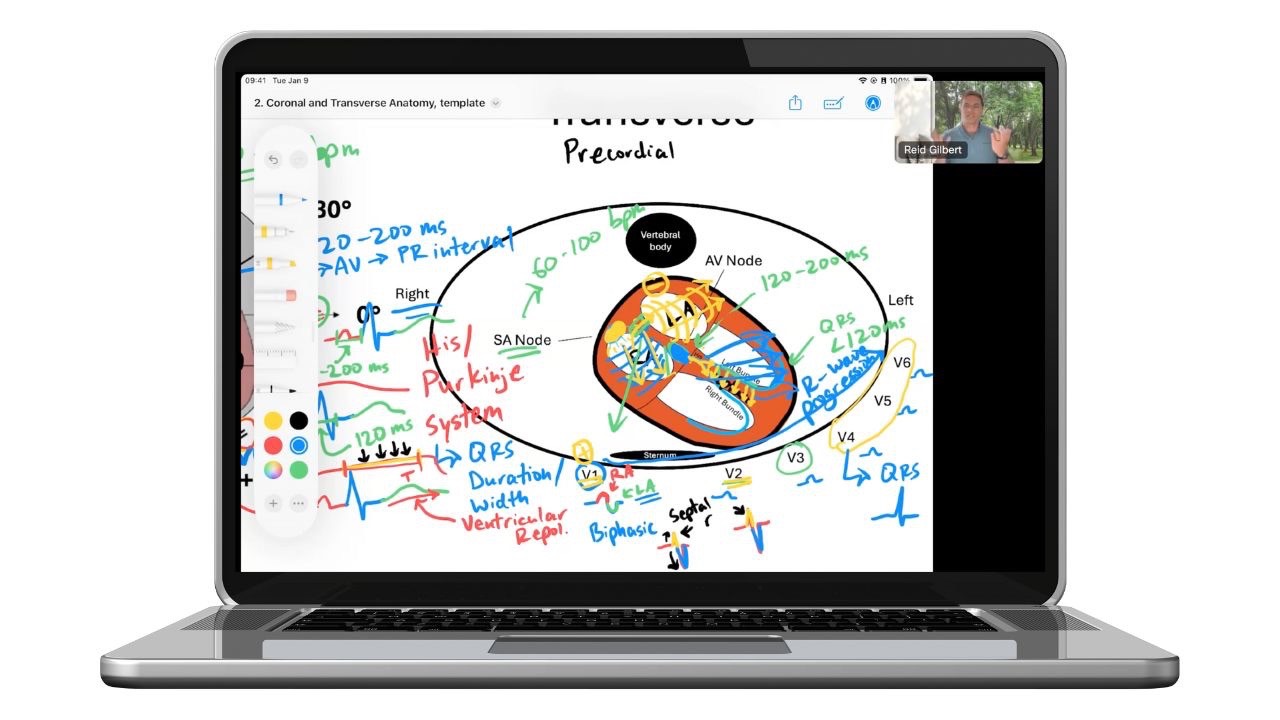 The ECG Blog with Reid