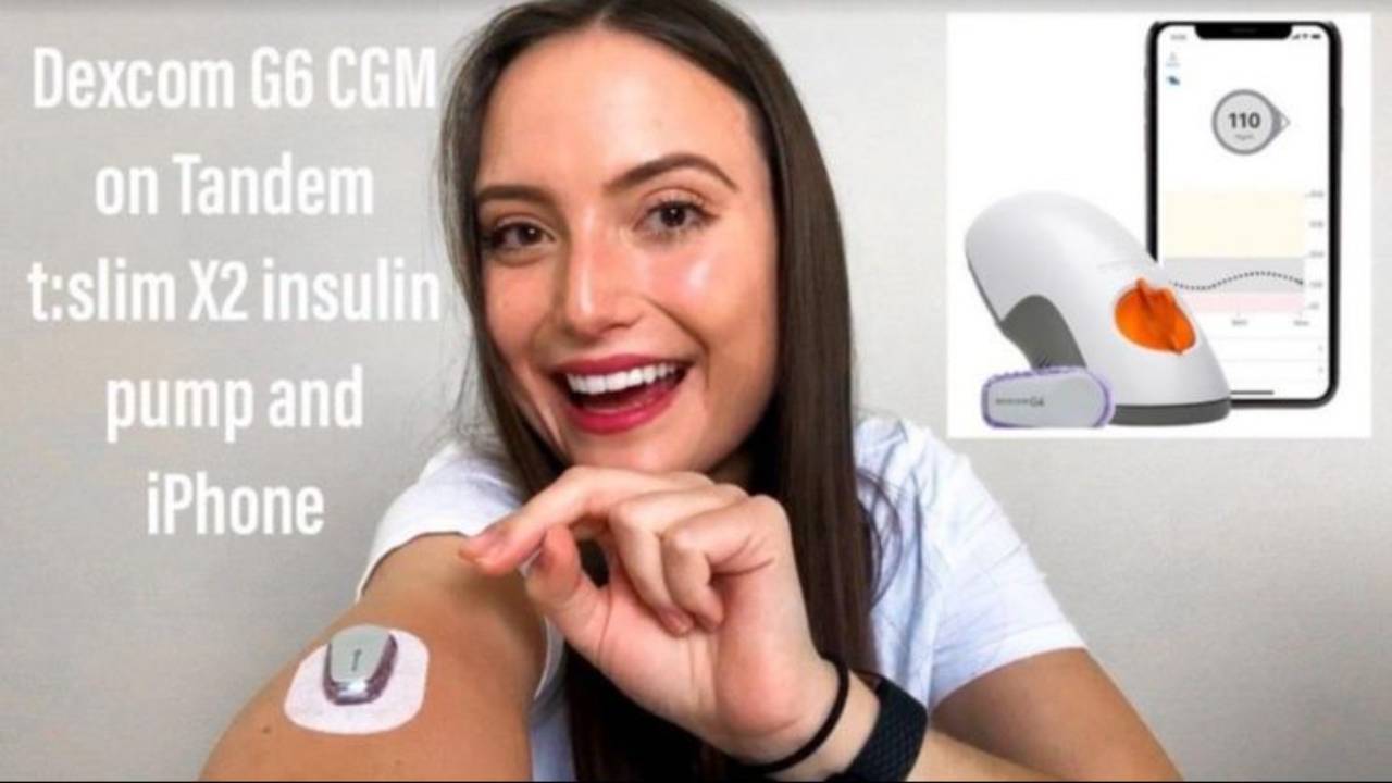 Dexcom G6 Beginner’s Guide: Top 10 Questions Answered