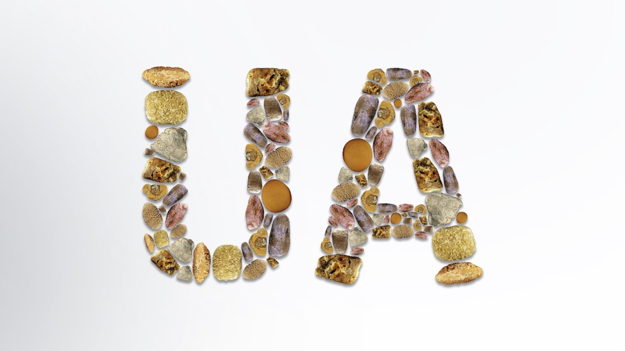 Uric Acid Kidney Stones: Types, Causes, and Fixes