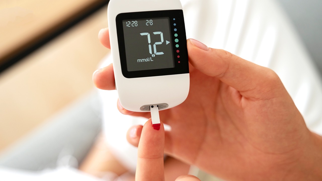 The Impact of Diabetes on Kidney Stones