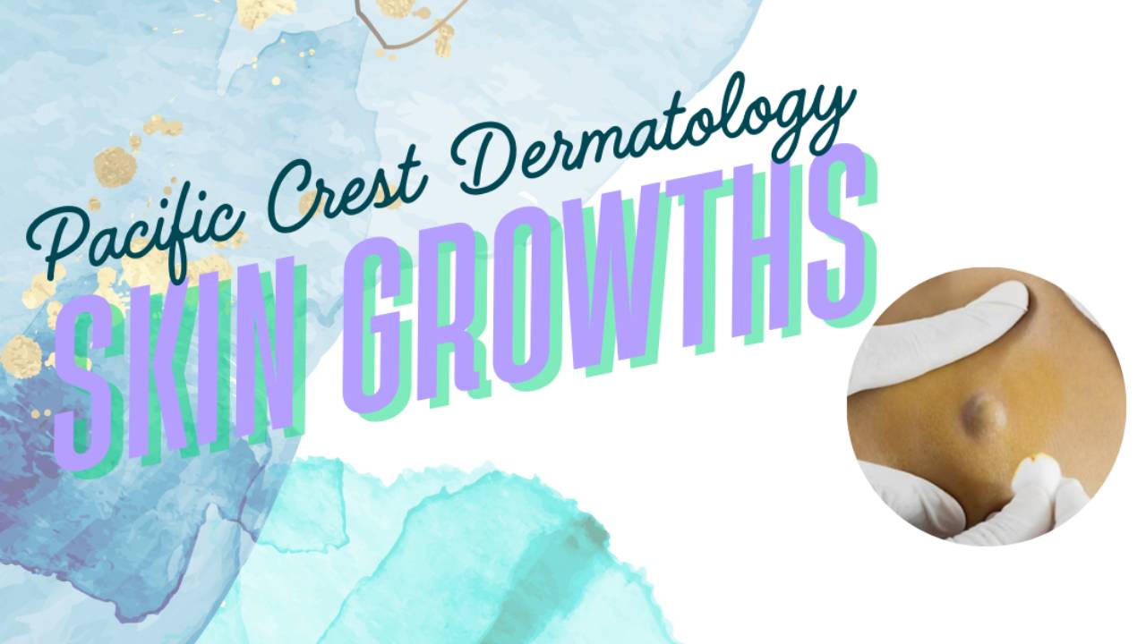 Skin Growths