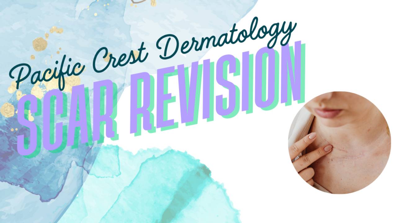 Scar Revision
