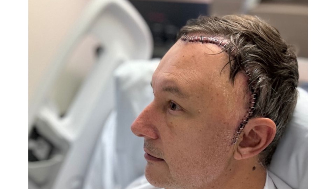 Six Lessons from Cranial Surgery | Mark Bolton