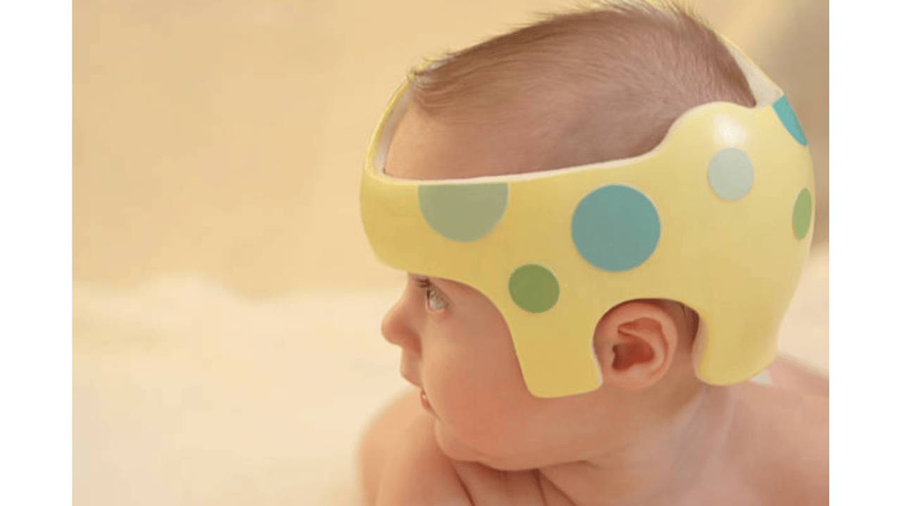Microcephaly and Plagiocephaly