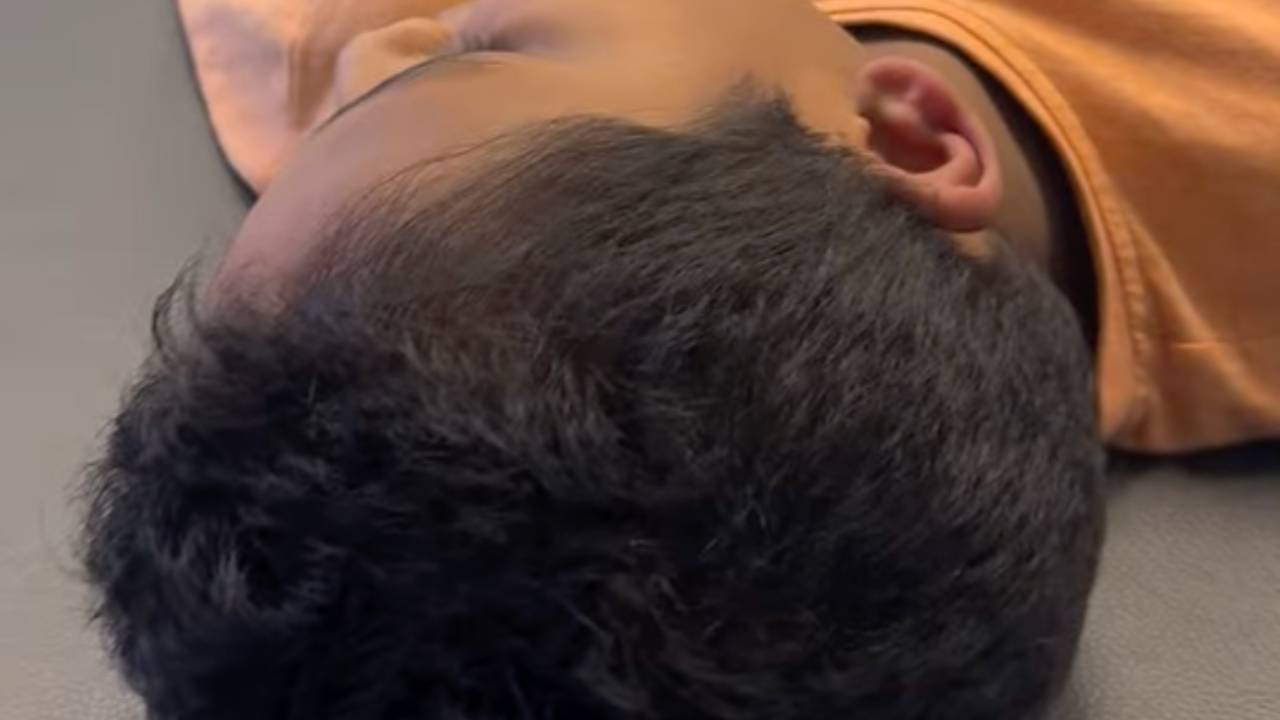 Midlines and the Head