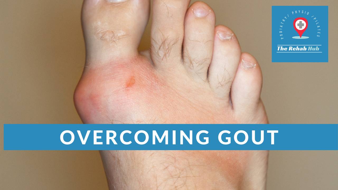Overcoming Gout