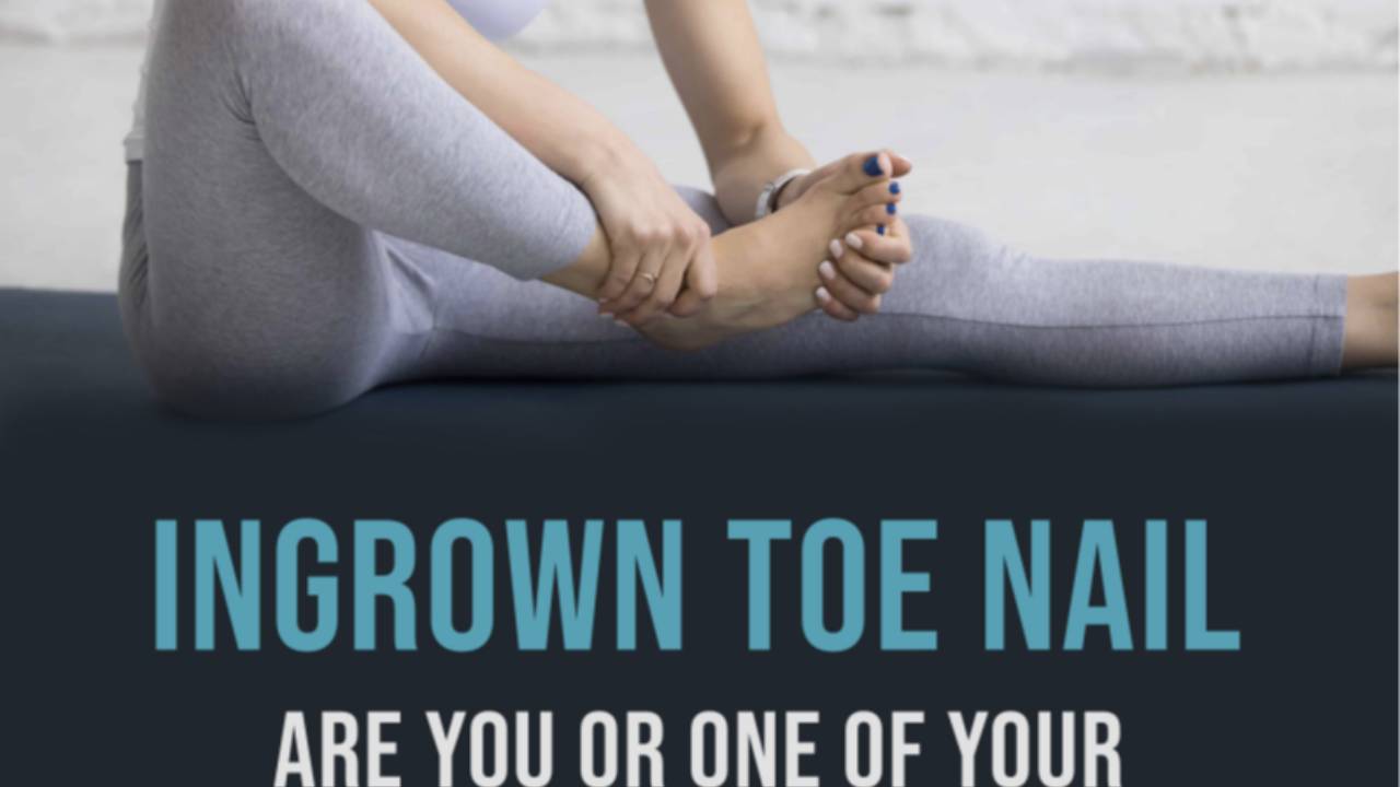 Free Ingrown Toenail Guide | South London Foot Clinic