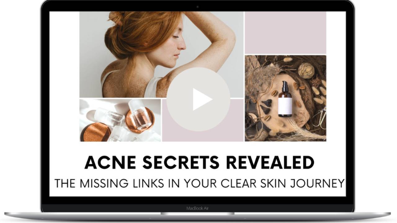 Free Acne Masterclass: Acne Secrets Revealed!