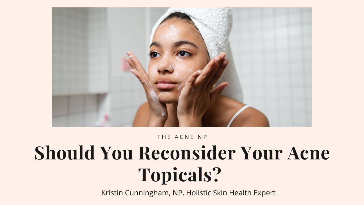 Should You Reconsider Your Acne Topicals? My Expert Opinion