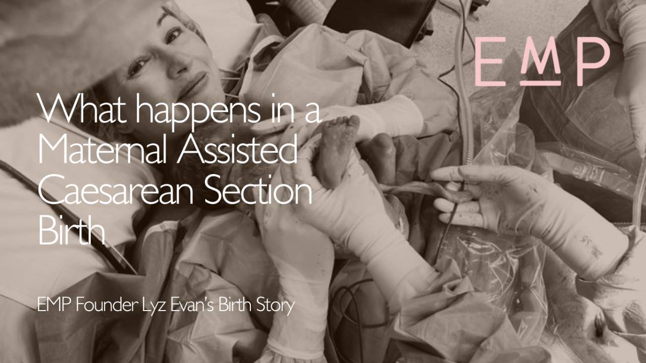 Maternal Assisted C-Section Birth - Lyz's Birth Story