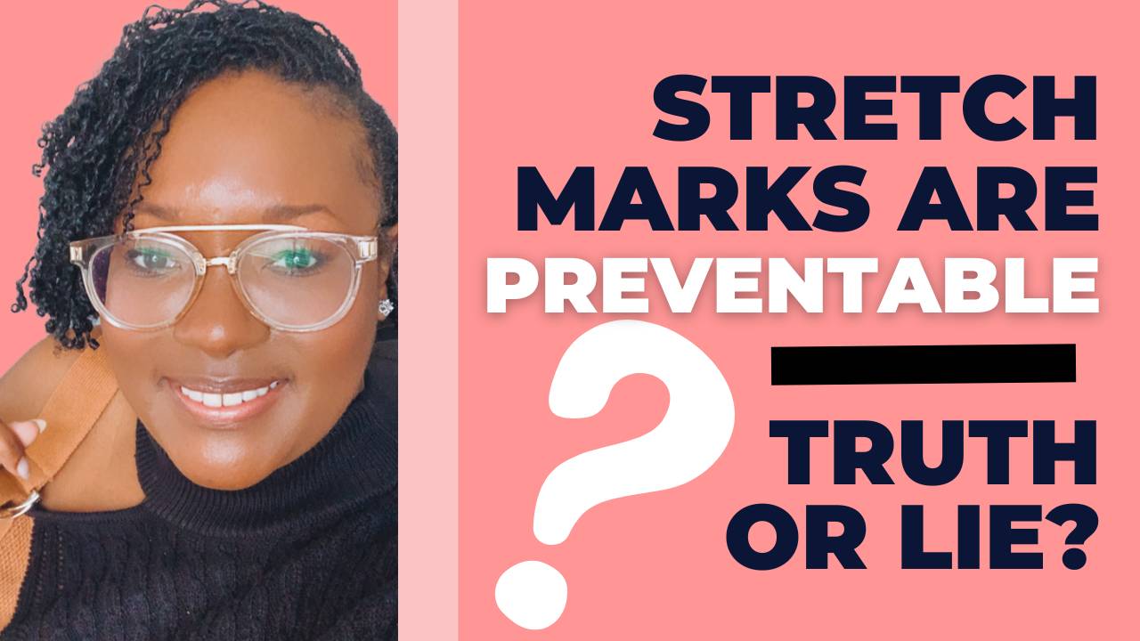 Stretch Marks Are Preventable: Truth or Lie?