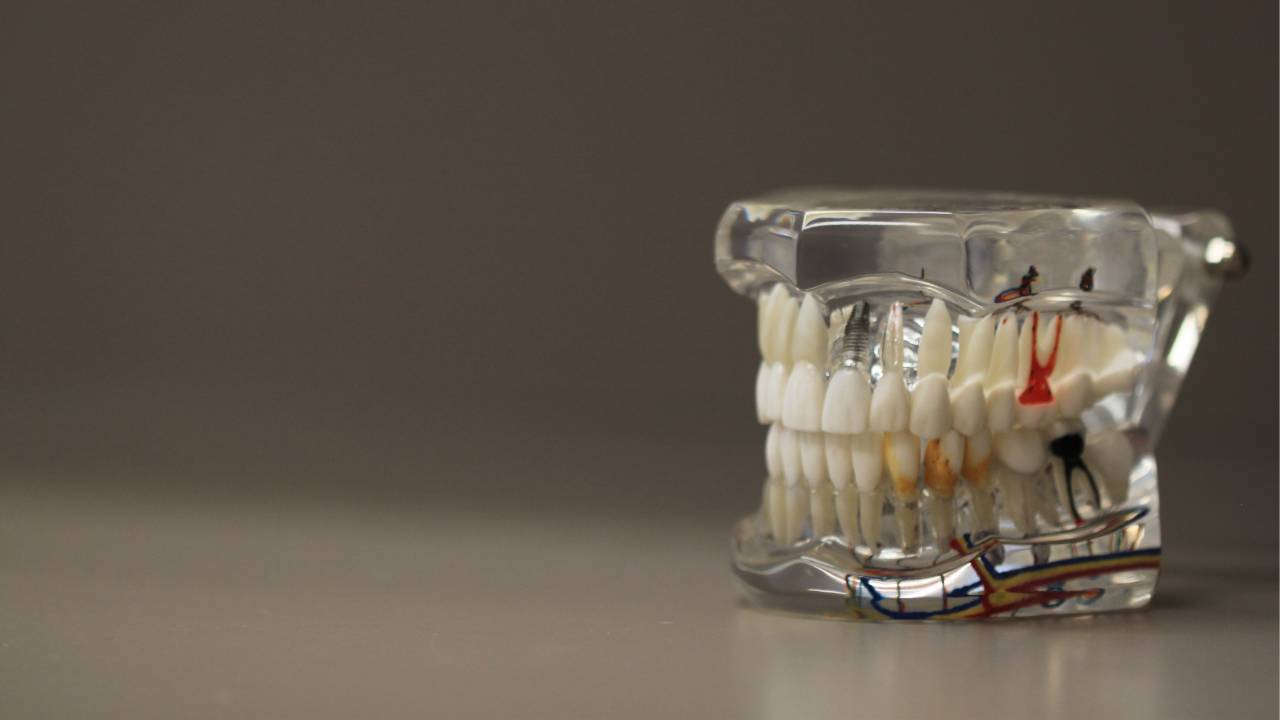 Jaw Structure Impacts Overall Health