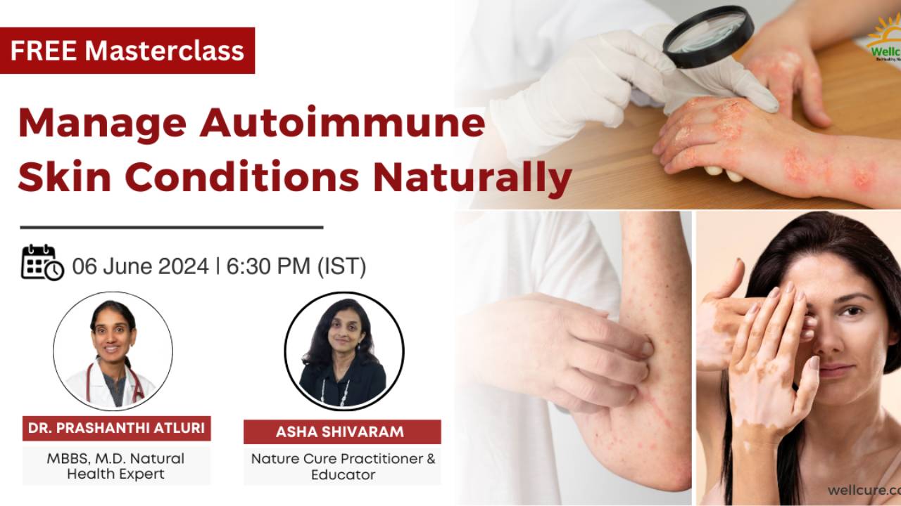 Manage Autoimmune Skin Conditions Naturally Free Masterclass