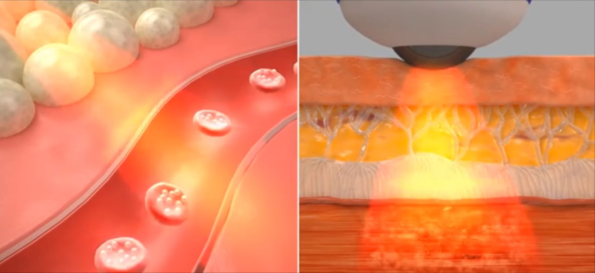 Class 4 Safe Laser Therapy | Pain Management |FormFunction and FlowLab