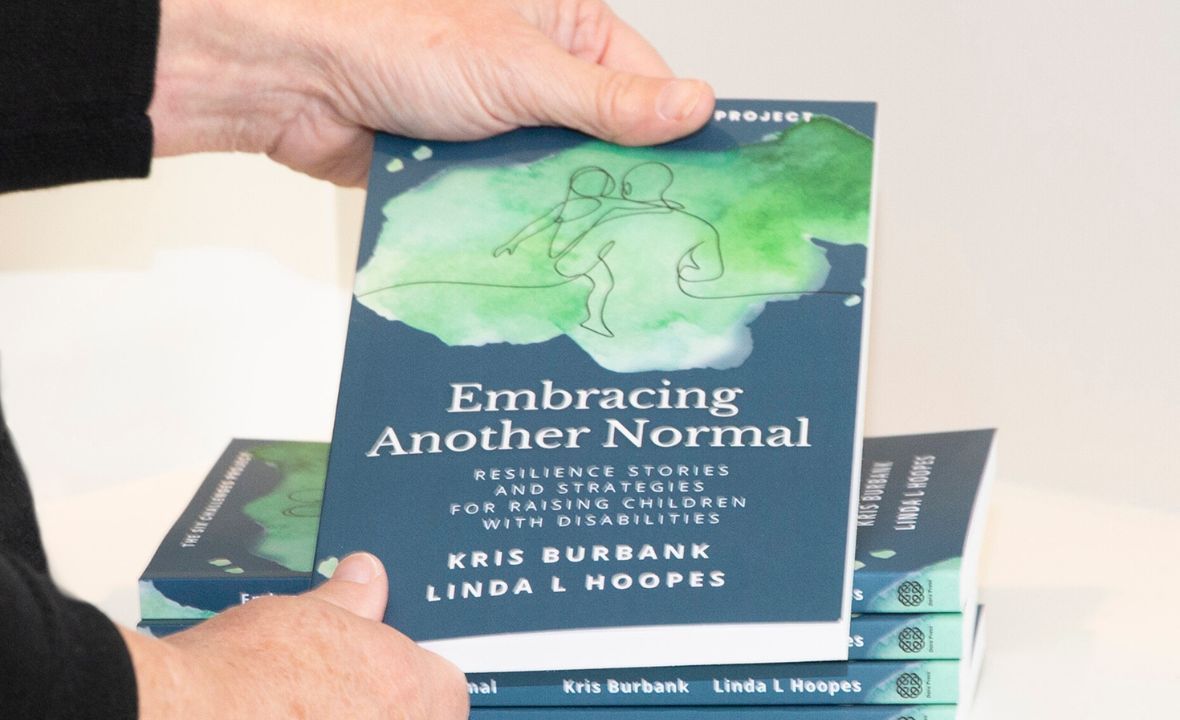 Embracing Another Normal