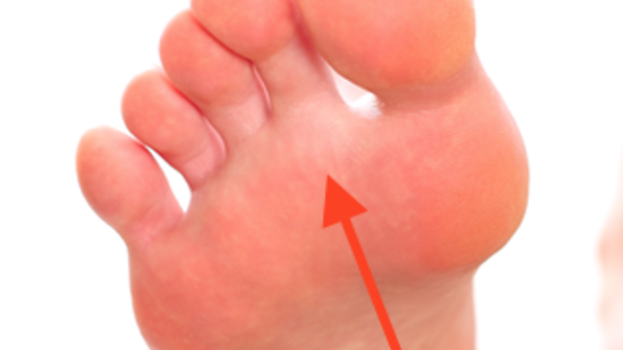 Plantar Plates - How to assess, diagnose & treat successfully