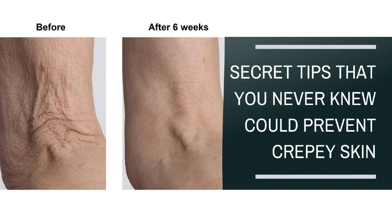 Secret Tips that you never knew could prevent Crepey Skin