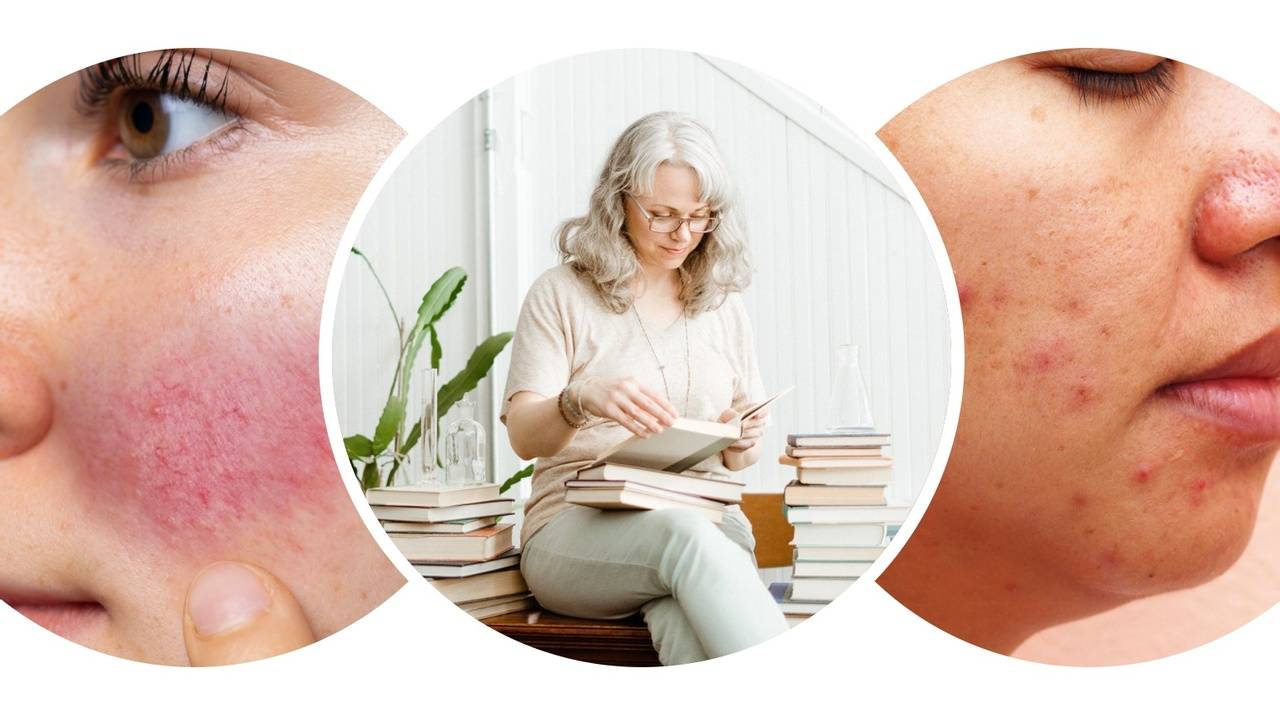 Take our FREE Keys to Chronic Skin Problems virtual class today