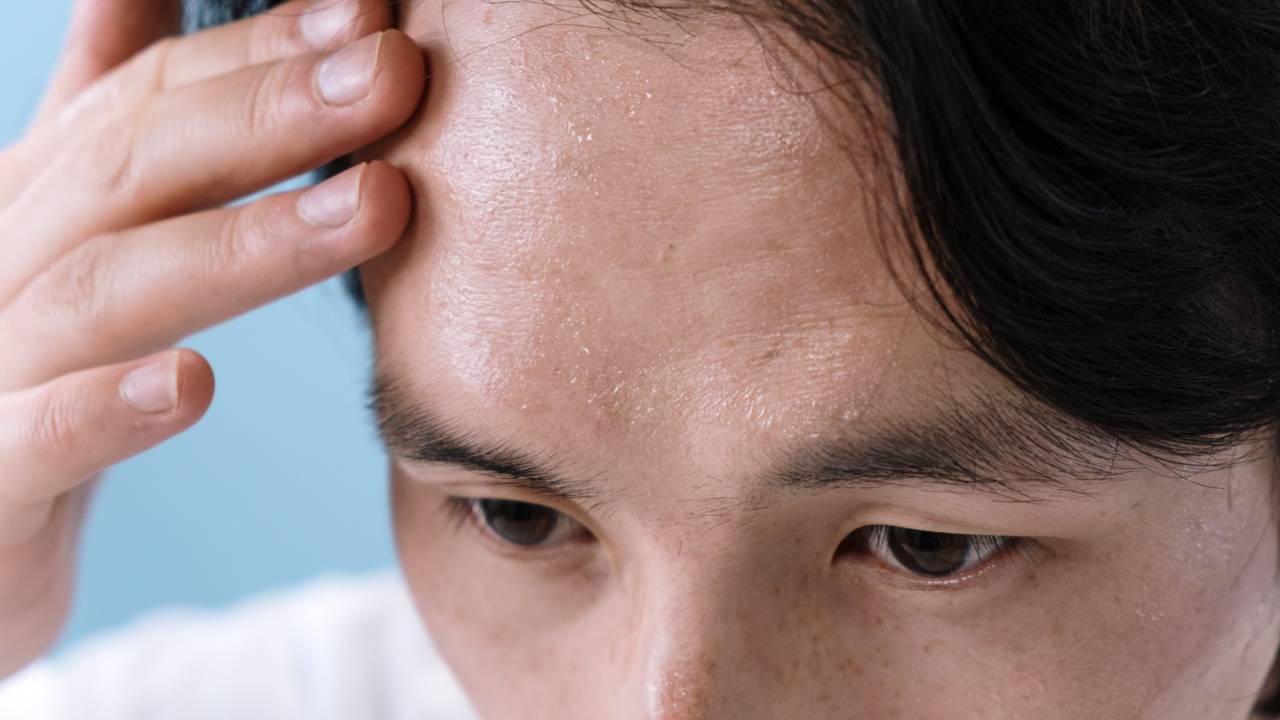 Stop Hair Pulling | Effective Treatment Strategies
