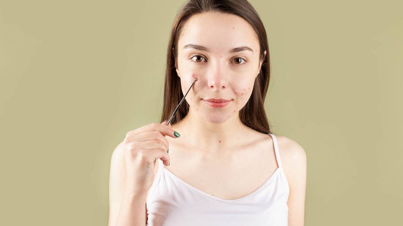 Compulsive Skin Picking - Causes, Diagnosis & Treatment