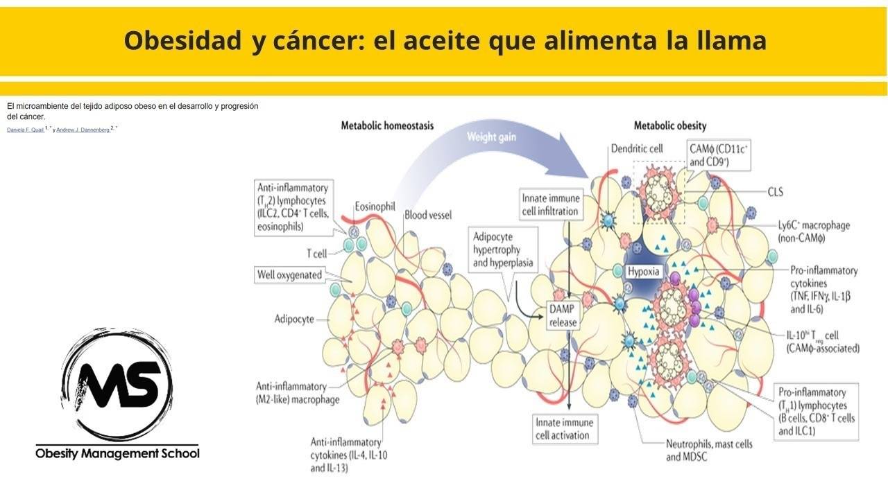 Obesidad y cáncer: el aceite que alimenta la llama