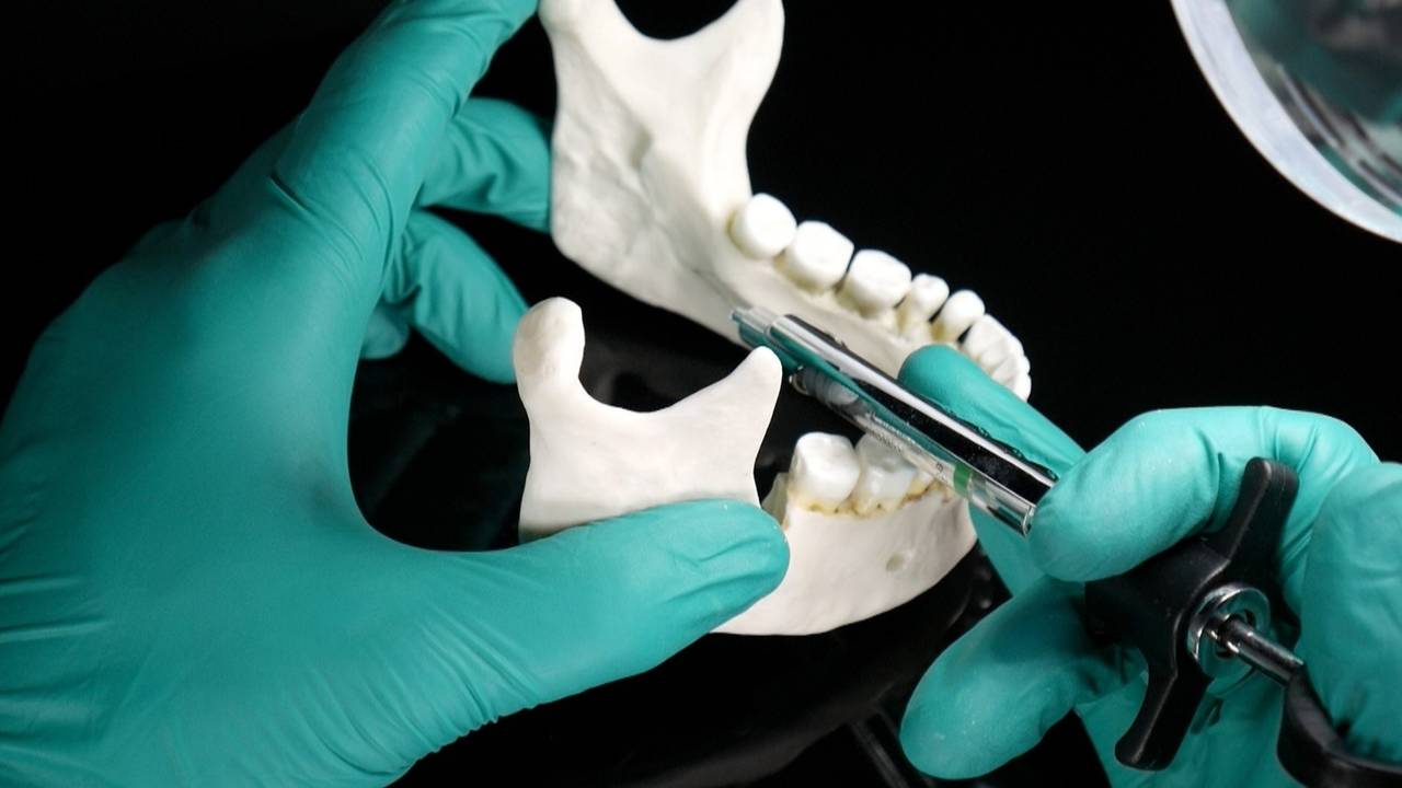 Online Dental Course | Preview | Local Anesthetic Master Course™