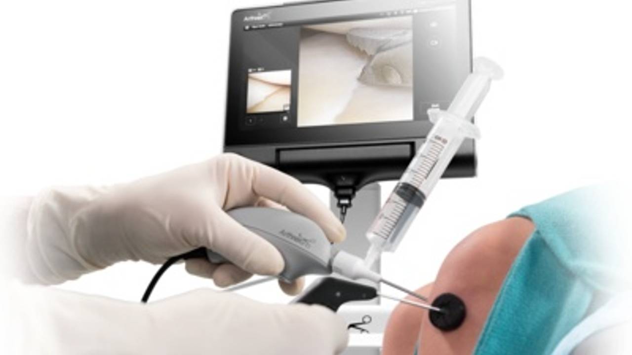 What is Office Needle Arthroscopy? Is it Right for me?