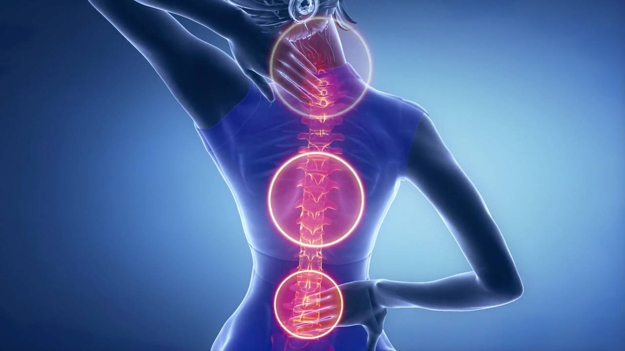 Exclusive Nerve and Disc Centers