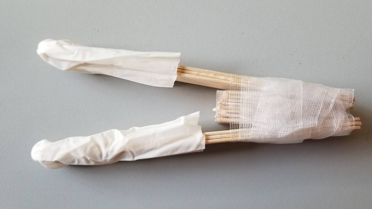 Is Trismus Curable After Head & Neck Cancer Treatment?