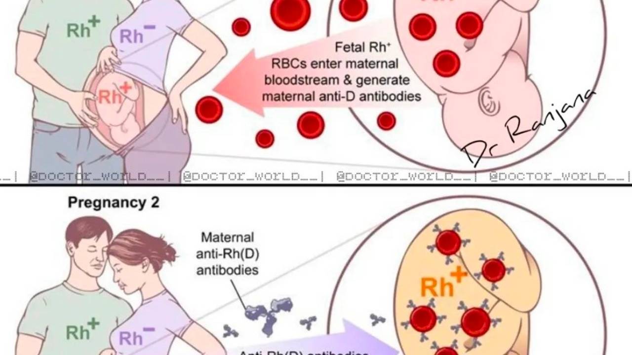 Just Call the Midwife: Rh negative and Need for Rhogam explained
