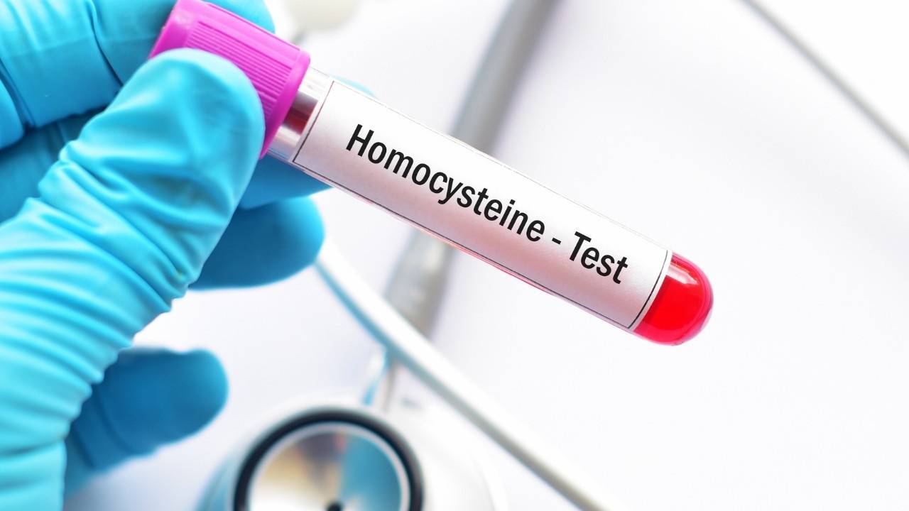 Your Homocysteine Levels