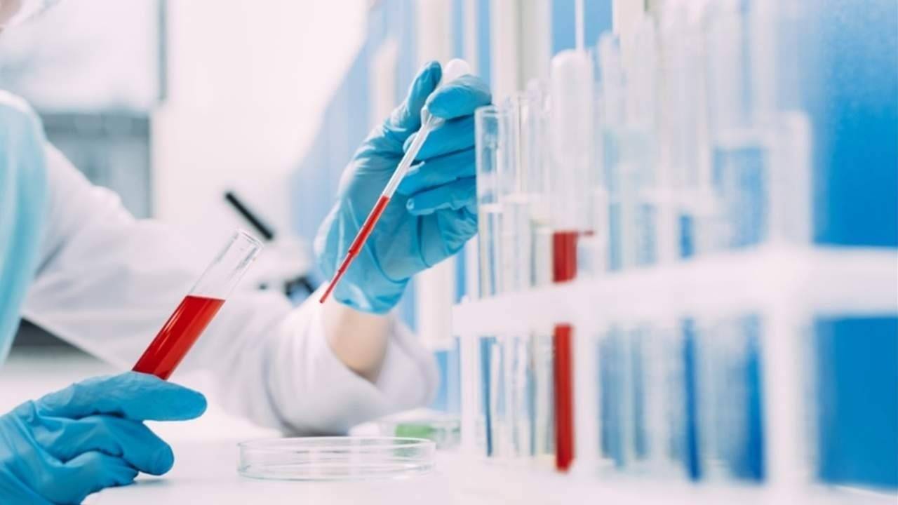 Lab Test Your Iron Status: Ferritin And Transferrin As Essentials