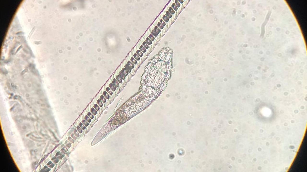 How to Get Rid of Parasites Naturally: Herbs To Kill Parasites