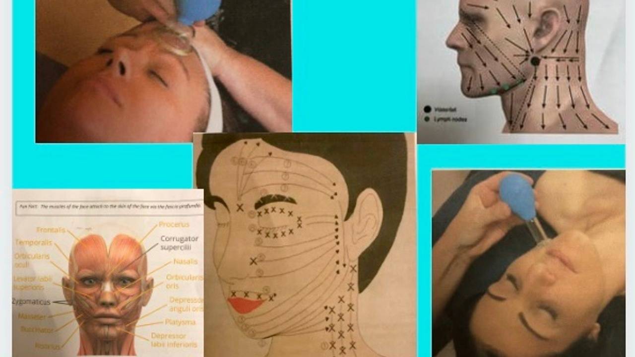 What is Facial Cupping?