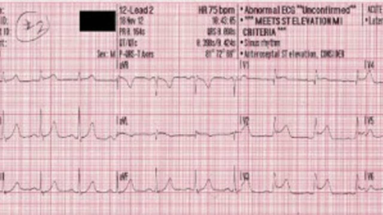 EKG Workshop by Jennifer Carlquist