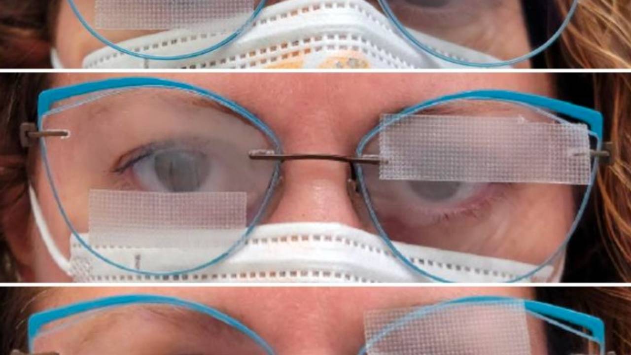 Foundations of Vision Therapy