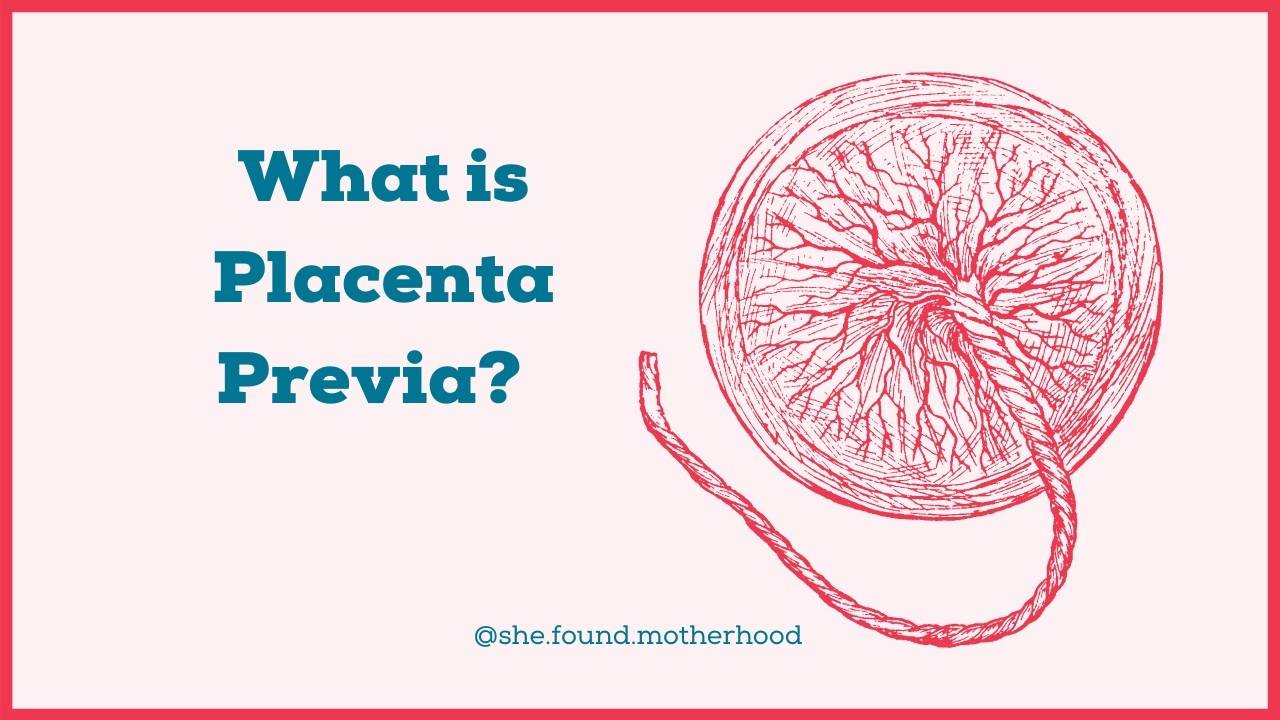 What is Placenta Previa?