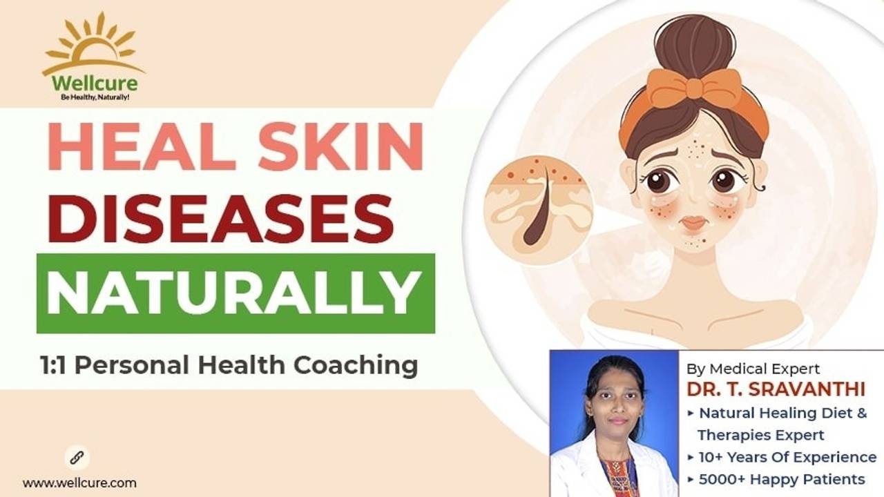Heal Skin Diseases Naturally Consultation/ Coaching by Dr. T Sravanthi