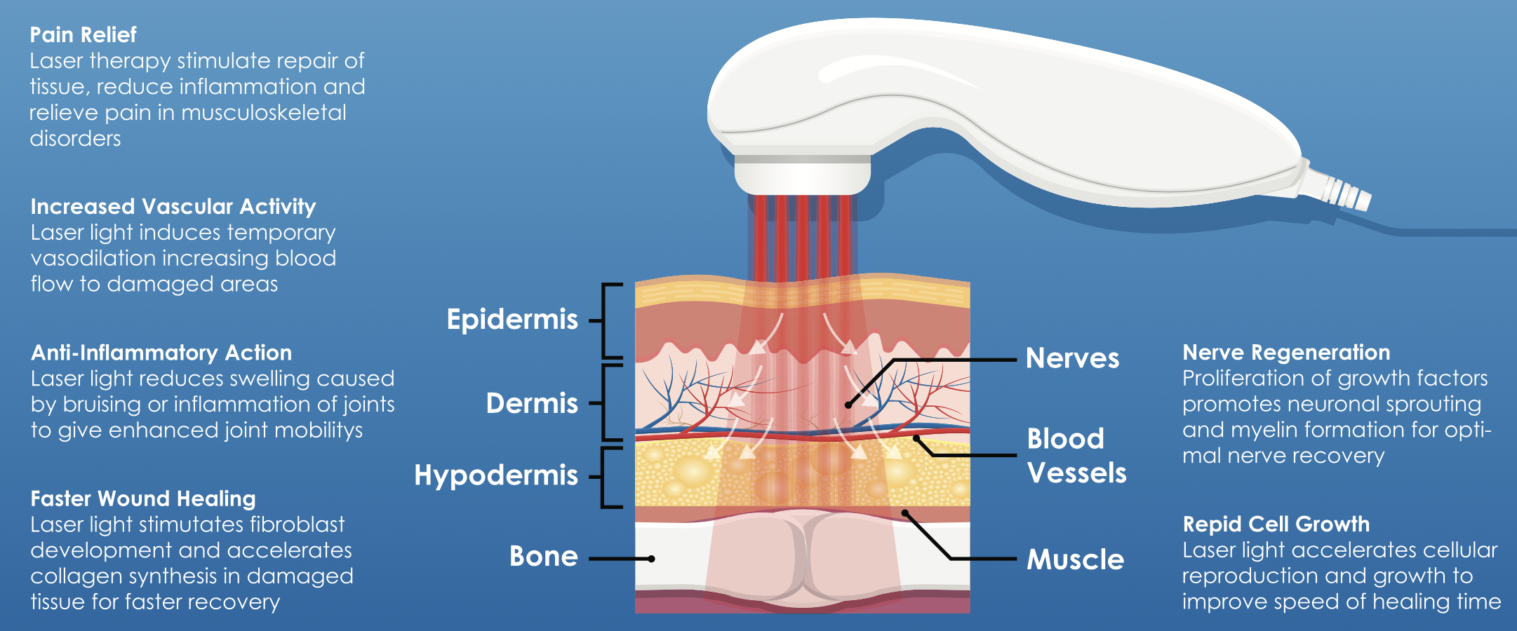 Laser Therapy Laser Therapy