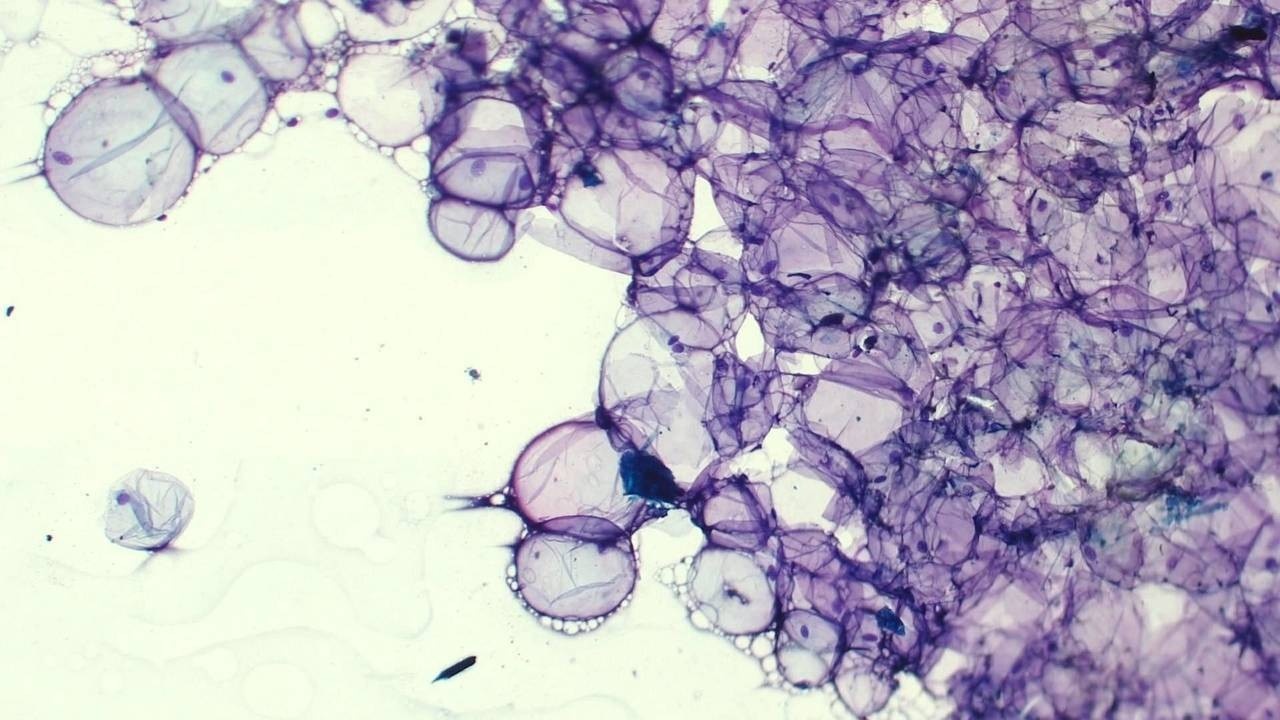 Cytology Course Thank You Cytology Course Thank You
